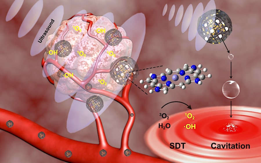 Une nouvelle forme de thérapie par ultrasons permet de neutraliser ...